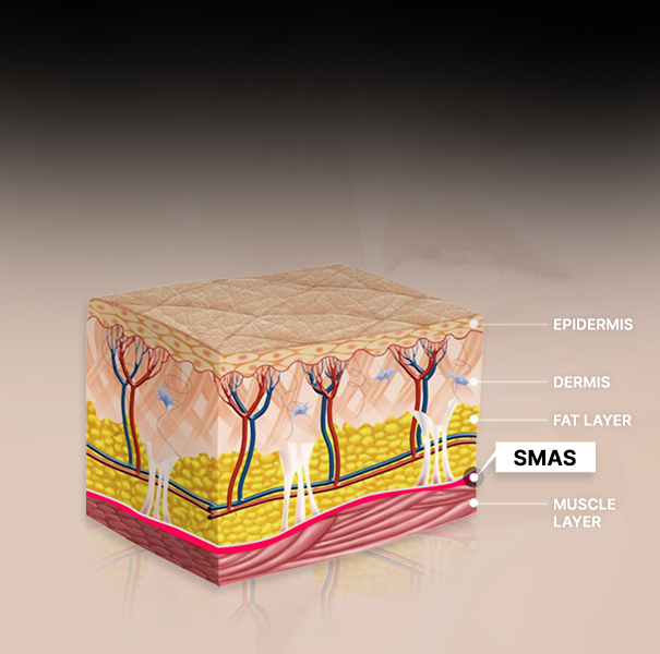 Key Doctor Plastic Surgery, Forehead lift